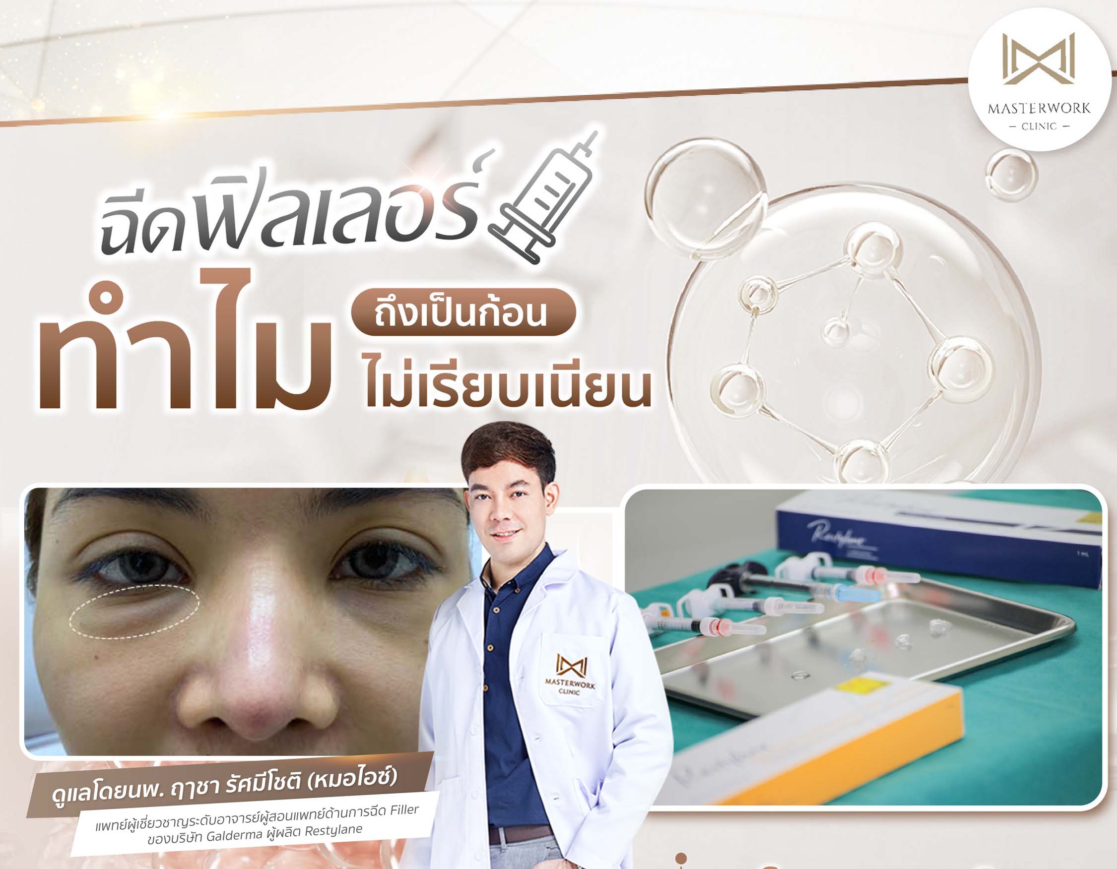 ฉีดฟิลเลอร์ใต้ตา แล้วเป็นก้อน เจาะลึกสาเหตุ วิธีแก้ไขและป้องกัน